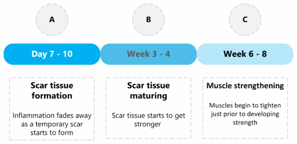 The Healing Process of Soft Tissue Injuries: Understanding the ...